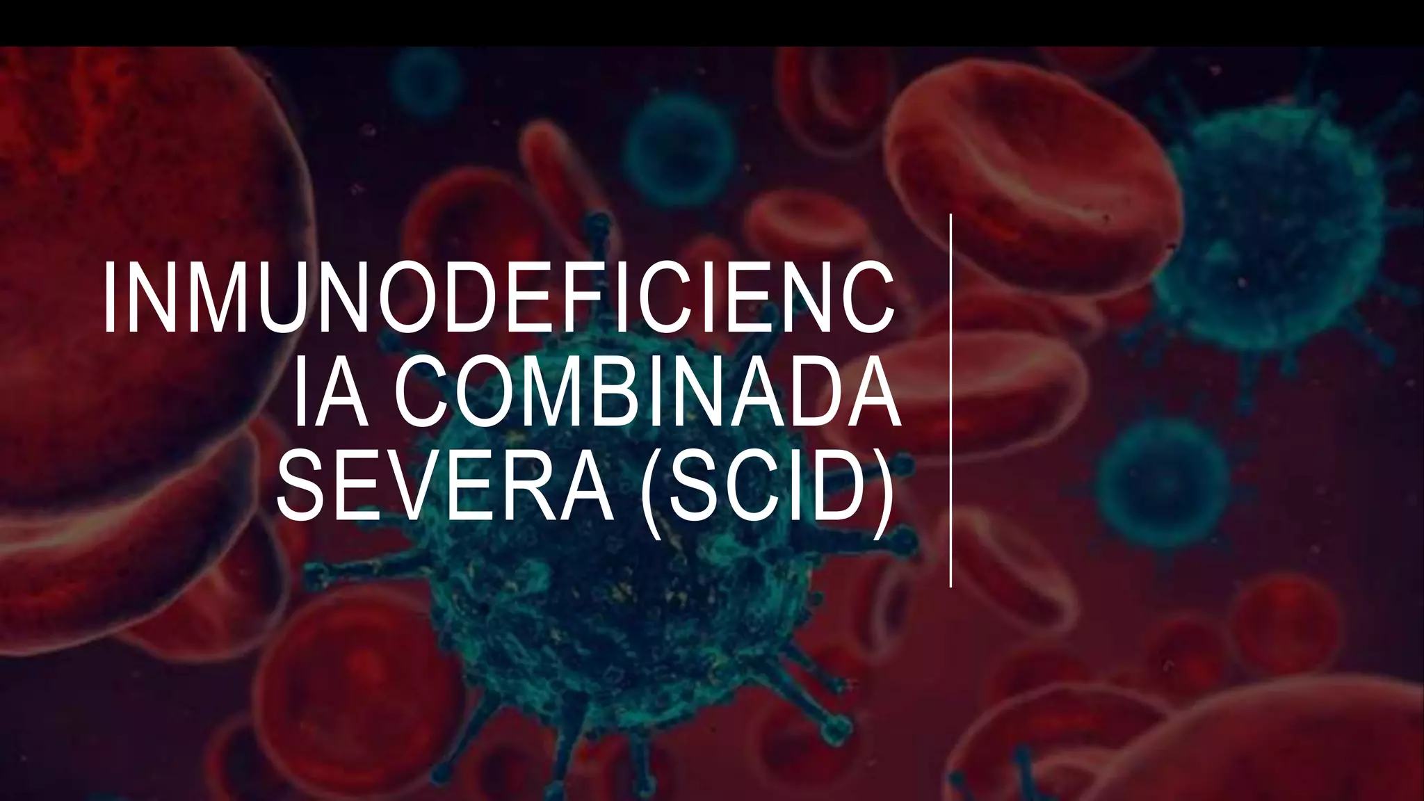 Inmunodeficiencia combinada severa (scid) | PPT