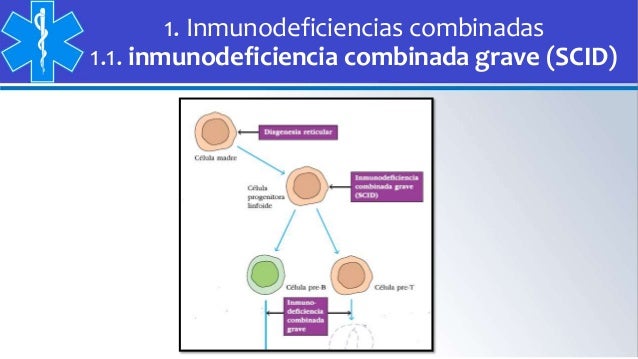 Inmunodeficiencias primarias: Inmunodeficiencias combinadas
