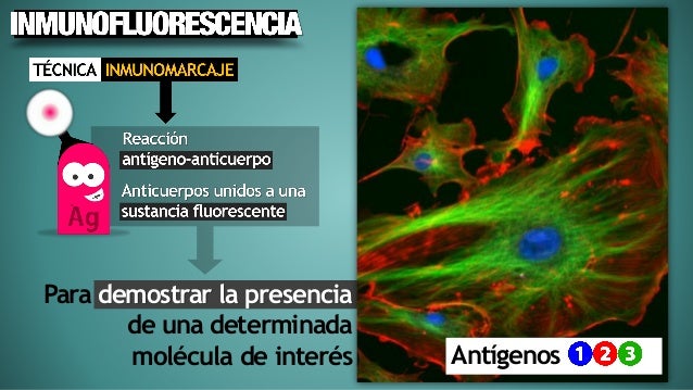 Inmunofluorescencia