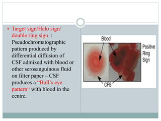 CSF LEAK AND ITS MANAGEMENT (CSF RHINORRHOEA, OTORRHOREA, OCCULORRHOEA ...