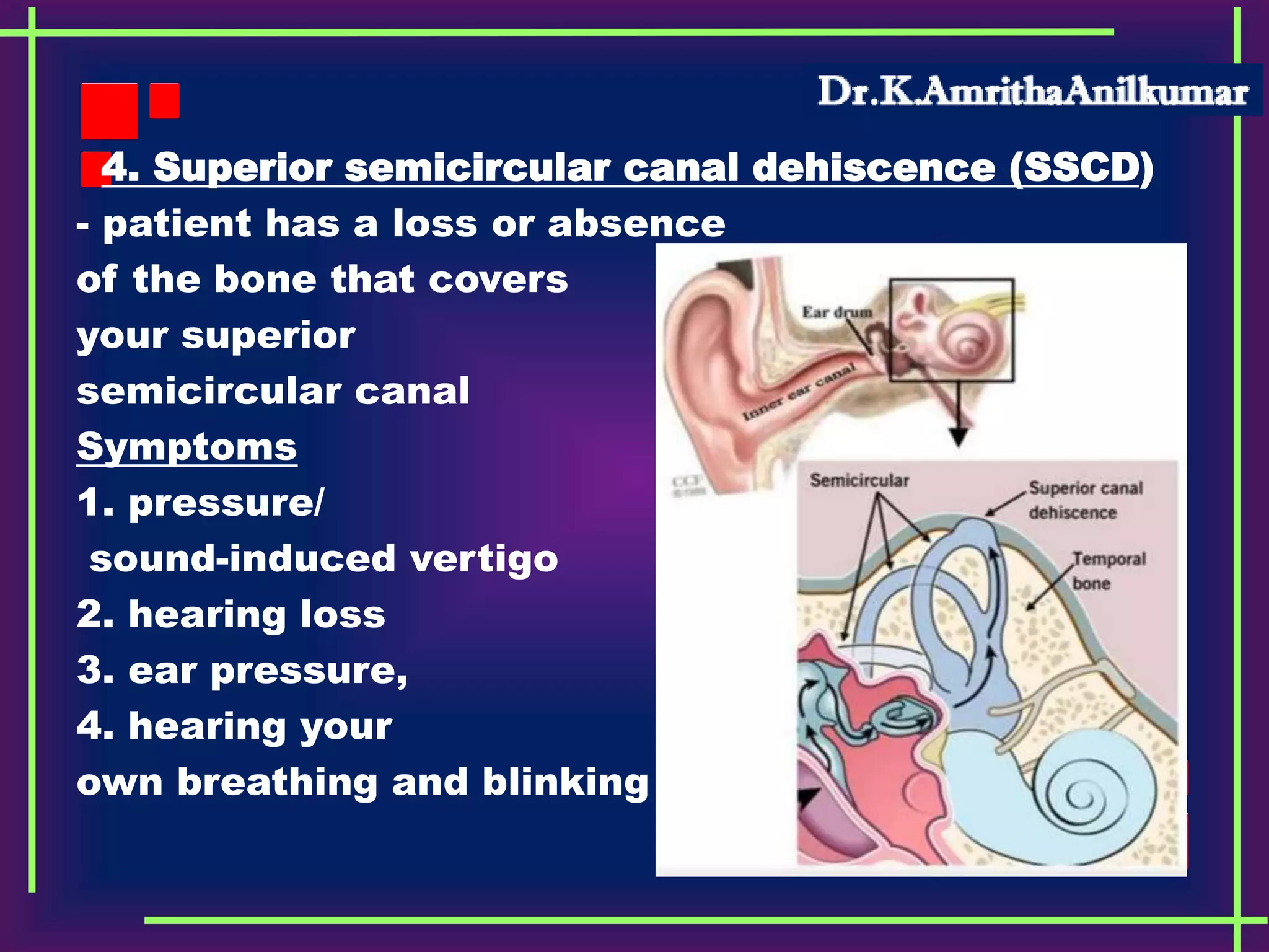Anatomy of ear(Part 3-Inner Ear) by Dr.K.AmrithaAnilkumar | PPT