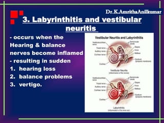 Anatomy of ear(Part 3-Inner Ear) by Dr.K.AmrithaAnilkumar | PPT