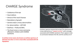 Inner ear malformations and Implantation | PPTX