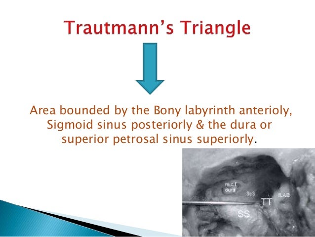 Anatomy of inner ear by Dr. Aditya Tiwari