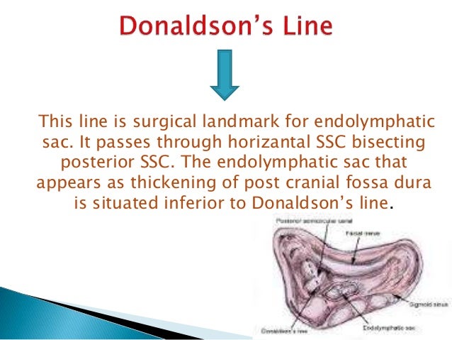 Anatomy of inner ear by Dr. Aditya Tiwari