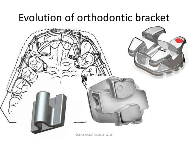 Innovation of orthodontics in the new millennium | PPT