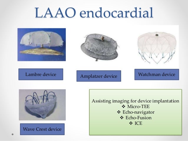 Innovations in Atrial fibrillation management