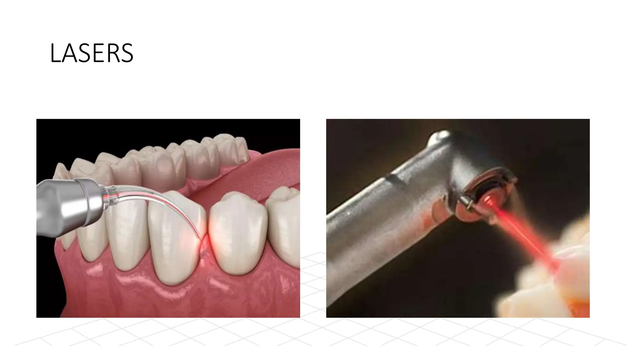 INNOVATIONS IN NON SURGICAL PERIODONTAL THERAPY.pptx