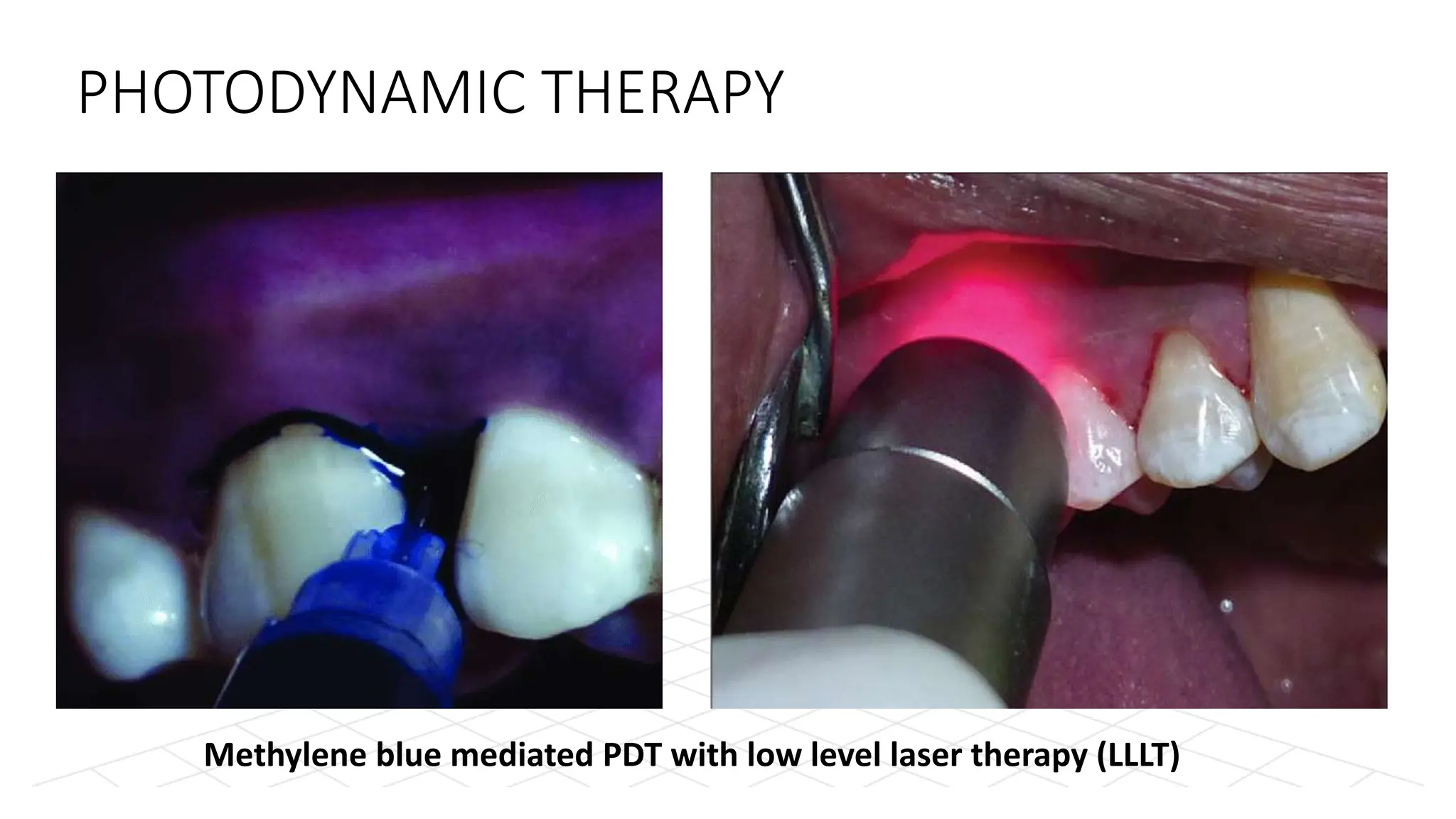 INNOVATIONS IN NON SURGICAL PERIODONTAL THERAPY.pptx