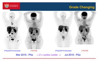 A retrospective study of dual 18F-fluorodeoxyglucose/68Gallium (FDG ...