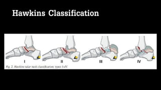 Case conference ortho ฐากูร | PPT