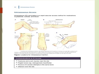 INOTROPES IN SHOCK.pptx