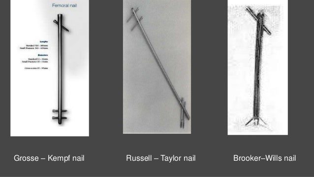 Inra medullary nailing - basic concepts