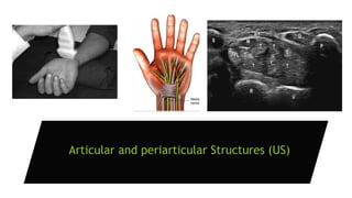 Inroduction to musculoskeletal ultrasound in rheumatology | PPT