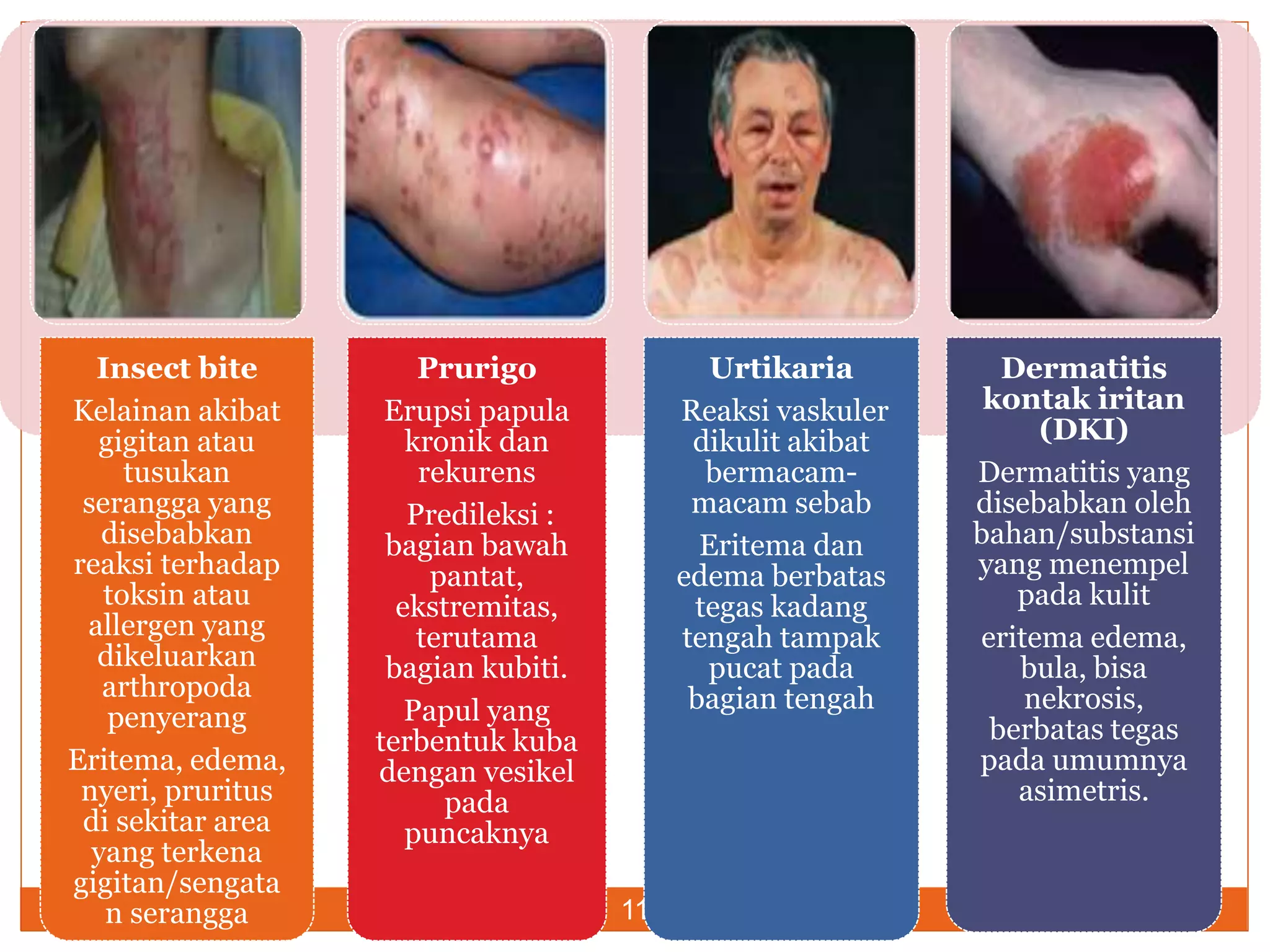 Insect Bite.pptx
