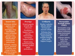 Insect Bite.pptx