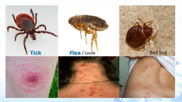Insect Sting and bite management.pptx