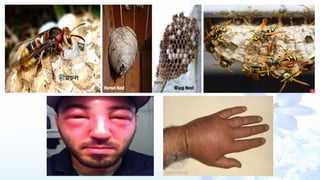 Insect Sting and bite management.pptx