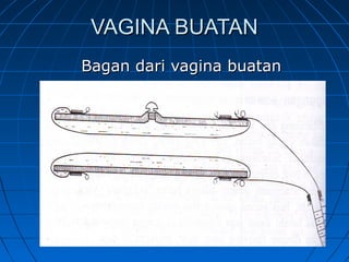 Inseminasi buatan pada sapi | PPT