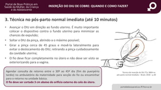 Inserção do DIU de cobre: quando e como fazer? | PPSX