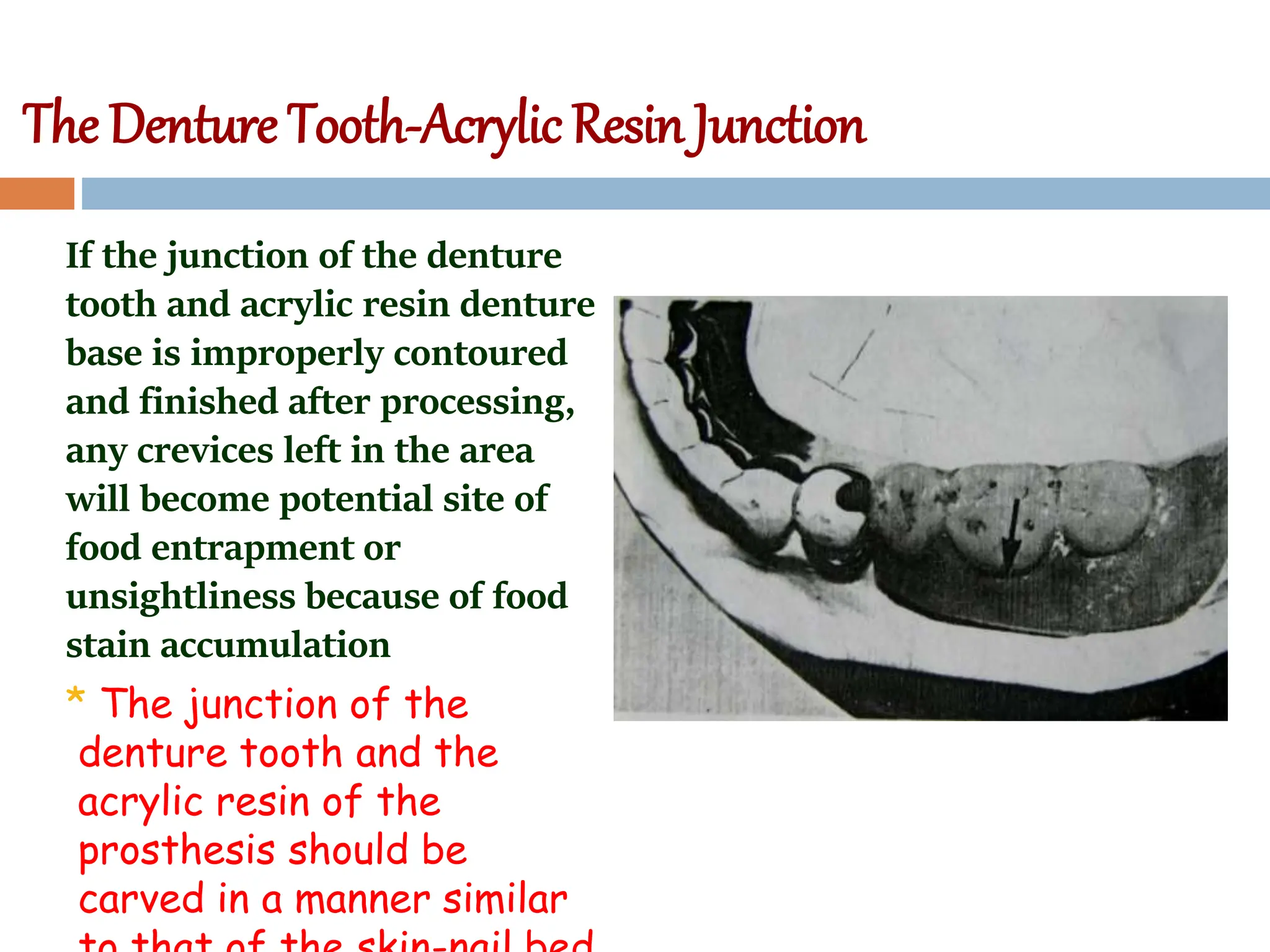 insertion-and-postinsertion-of-Removable partial denture | PPT