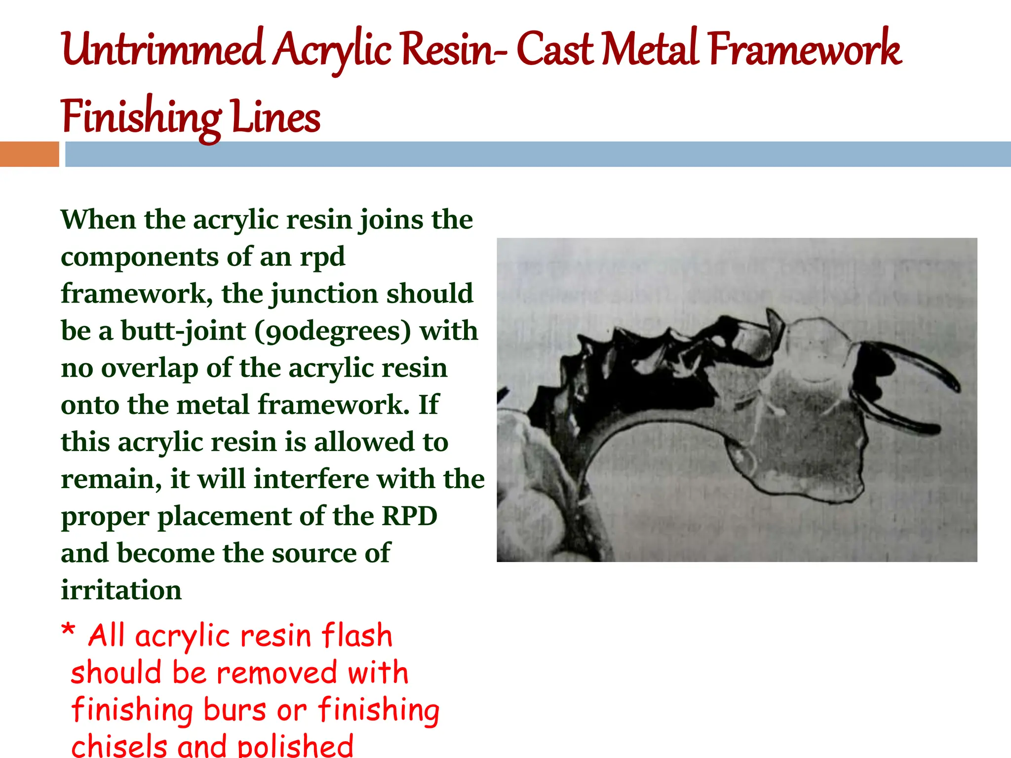 insertion-and-postinsertion-of-Removable partial denture | PPT