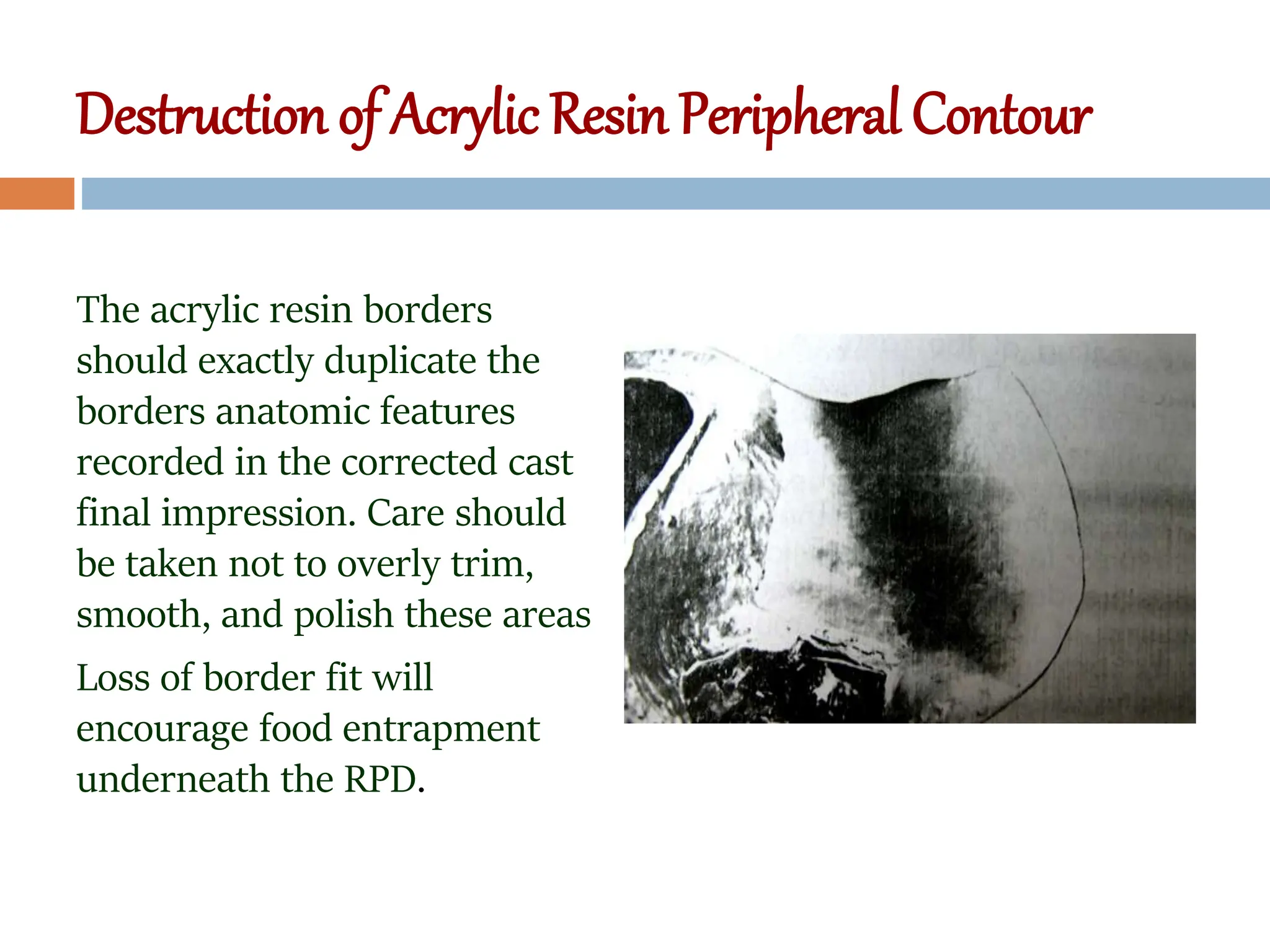 insertion-and-postinsertion-of-Removable partial denture | PPT