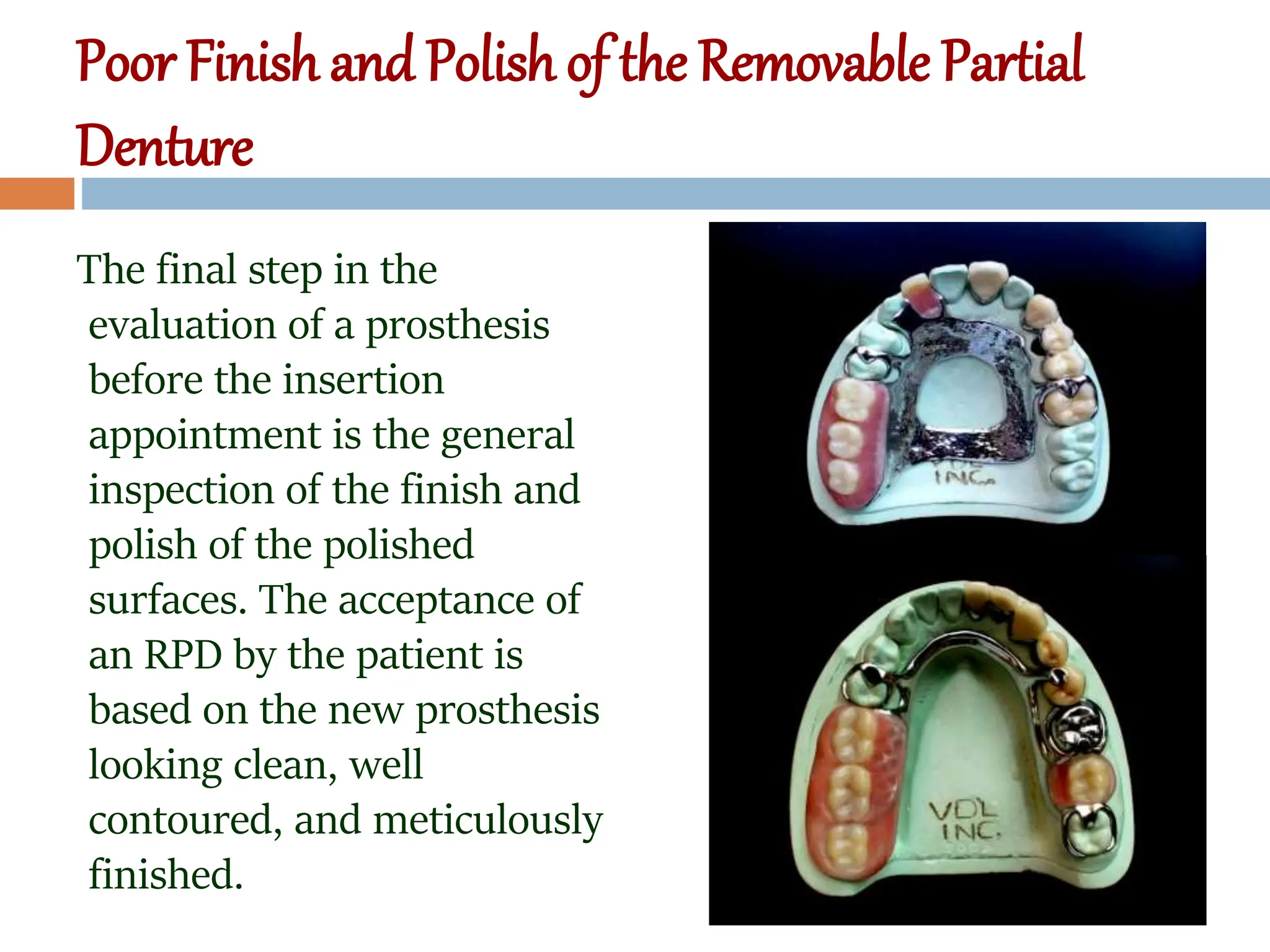 insertion-and-postinsertion-of-Removable partial denture | PPT