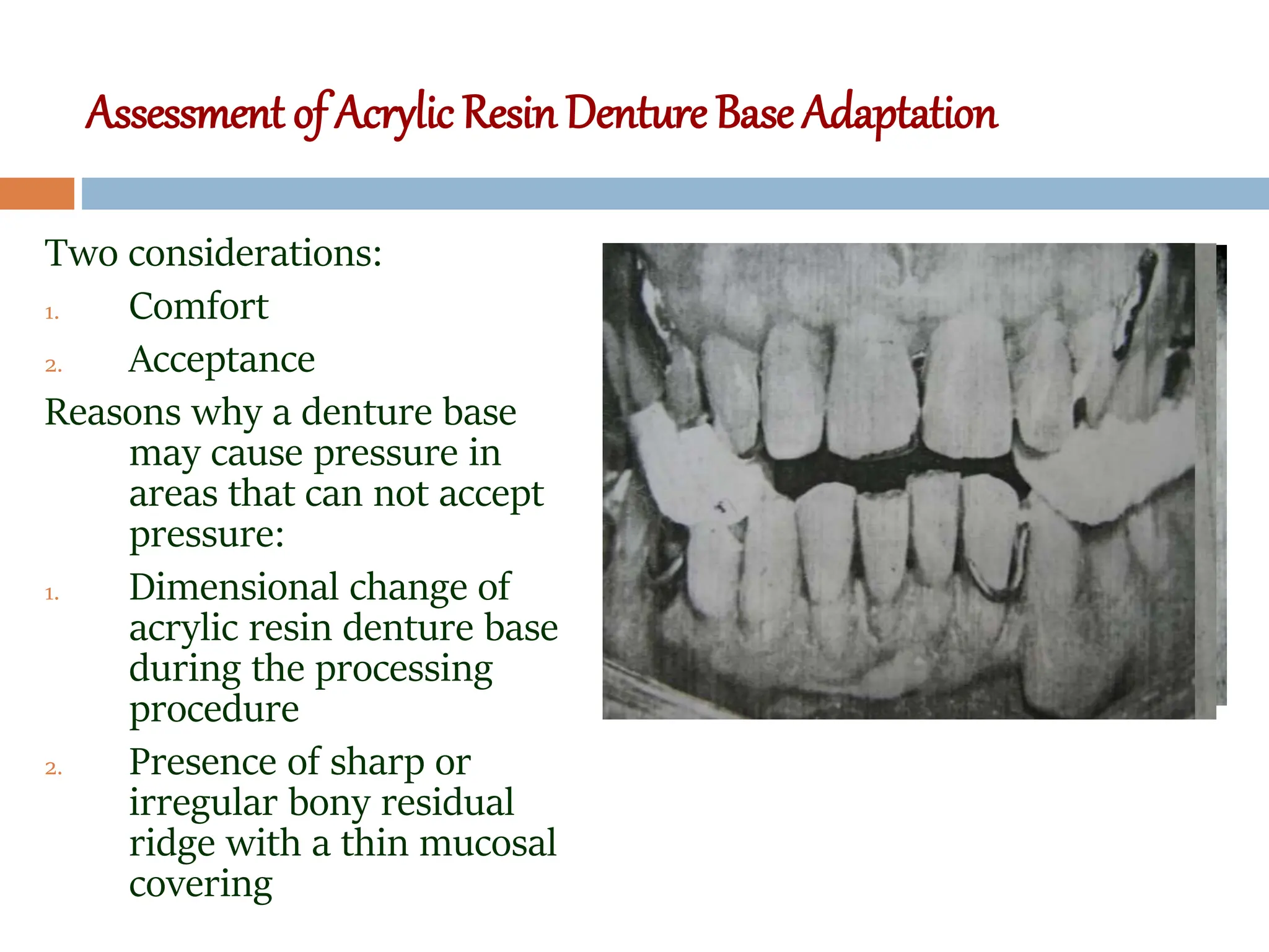 insertion-and-postinsertion-of-Removable partial denture | PPT