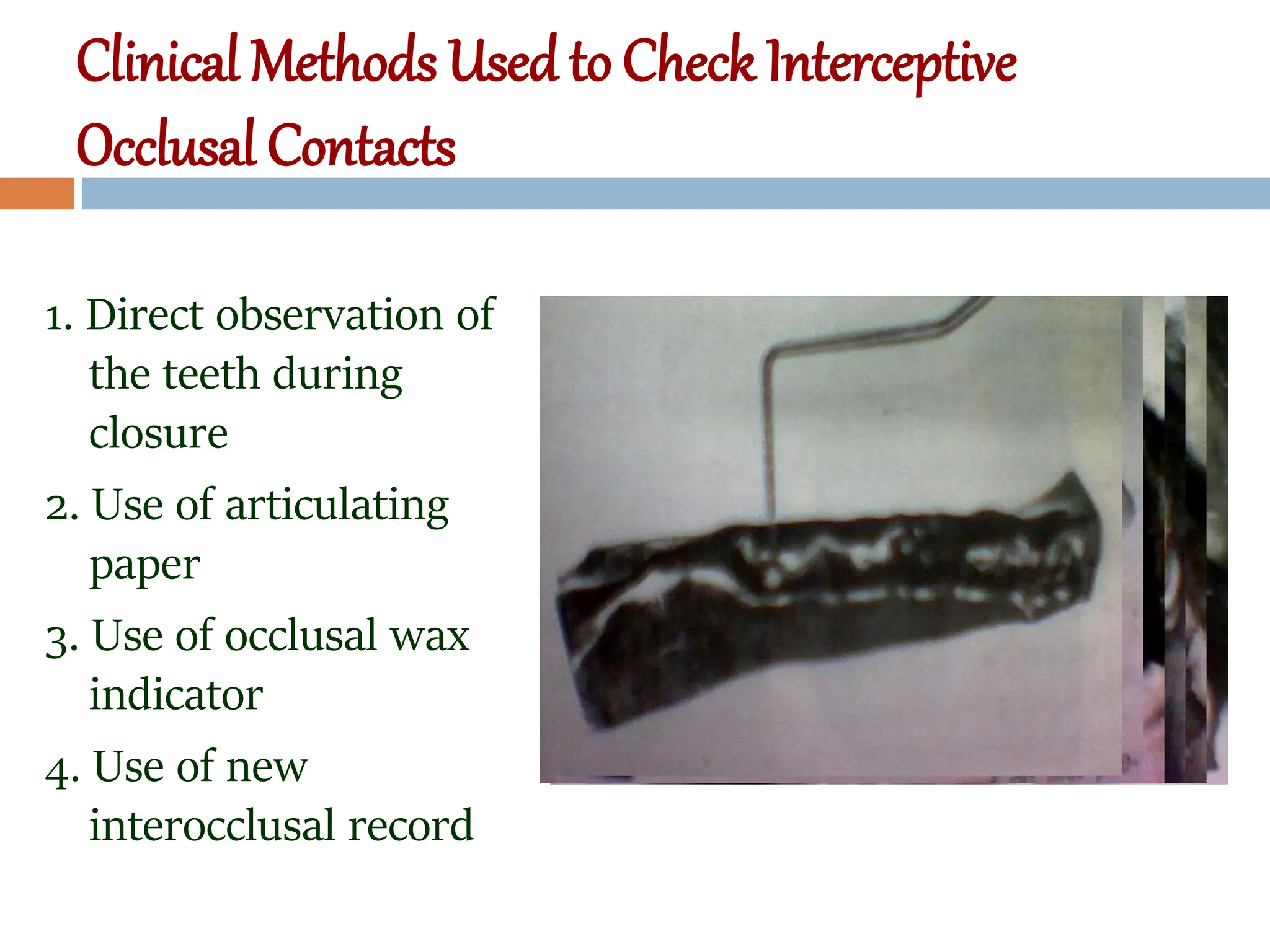 insertion-and-postinsertion-of-Removable partial denture | PPT