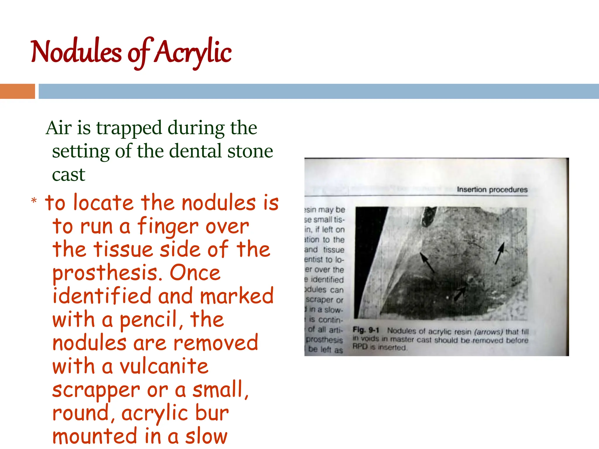 insertion-and-postinsertion-of-Removable partial denture | PPT