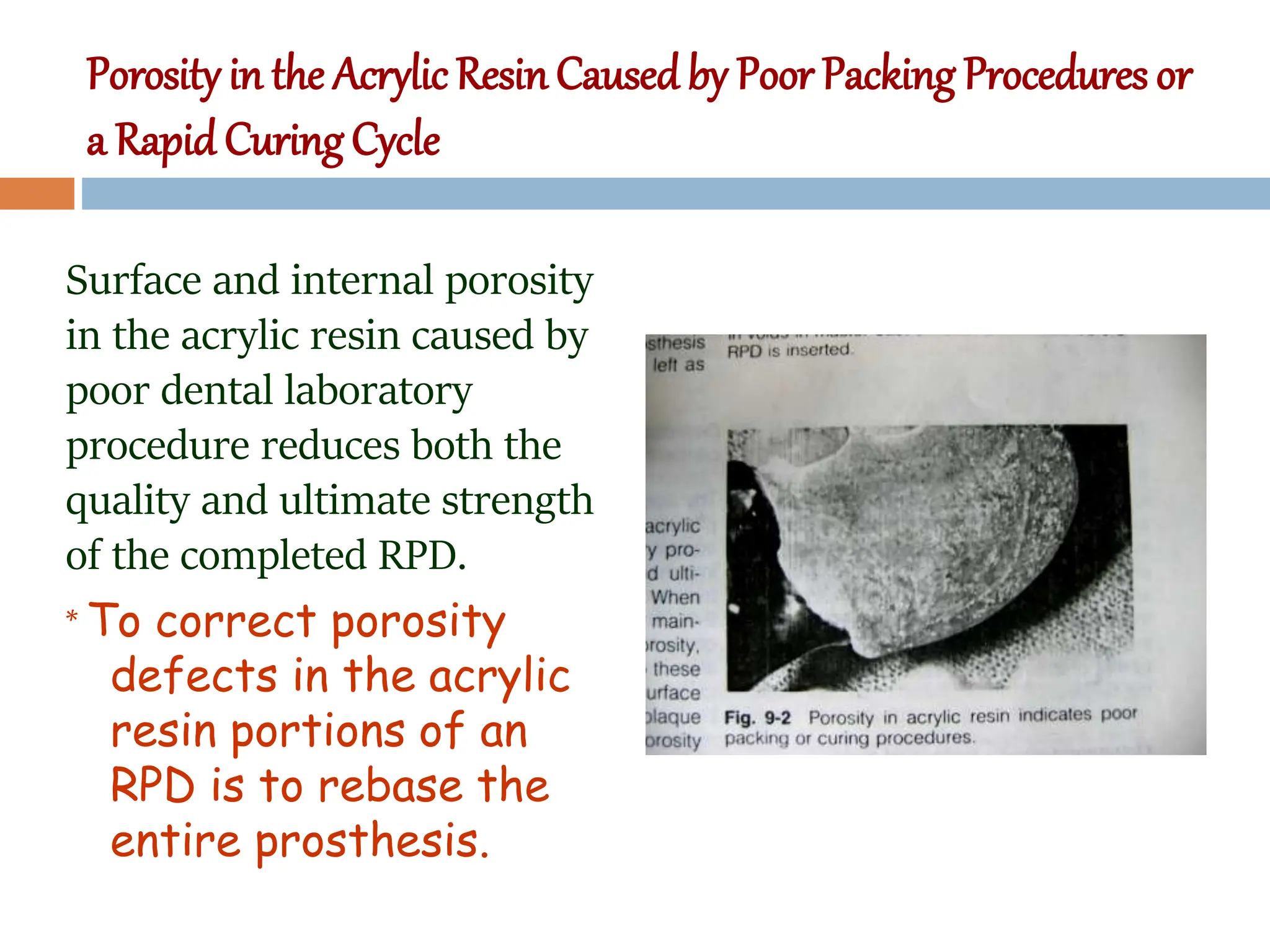 insertion-and-postinsertion-of-Removable partial denture | PPT