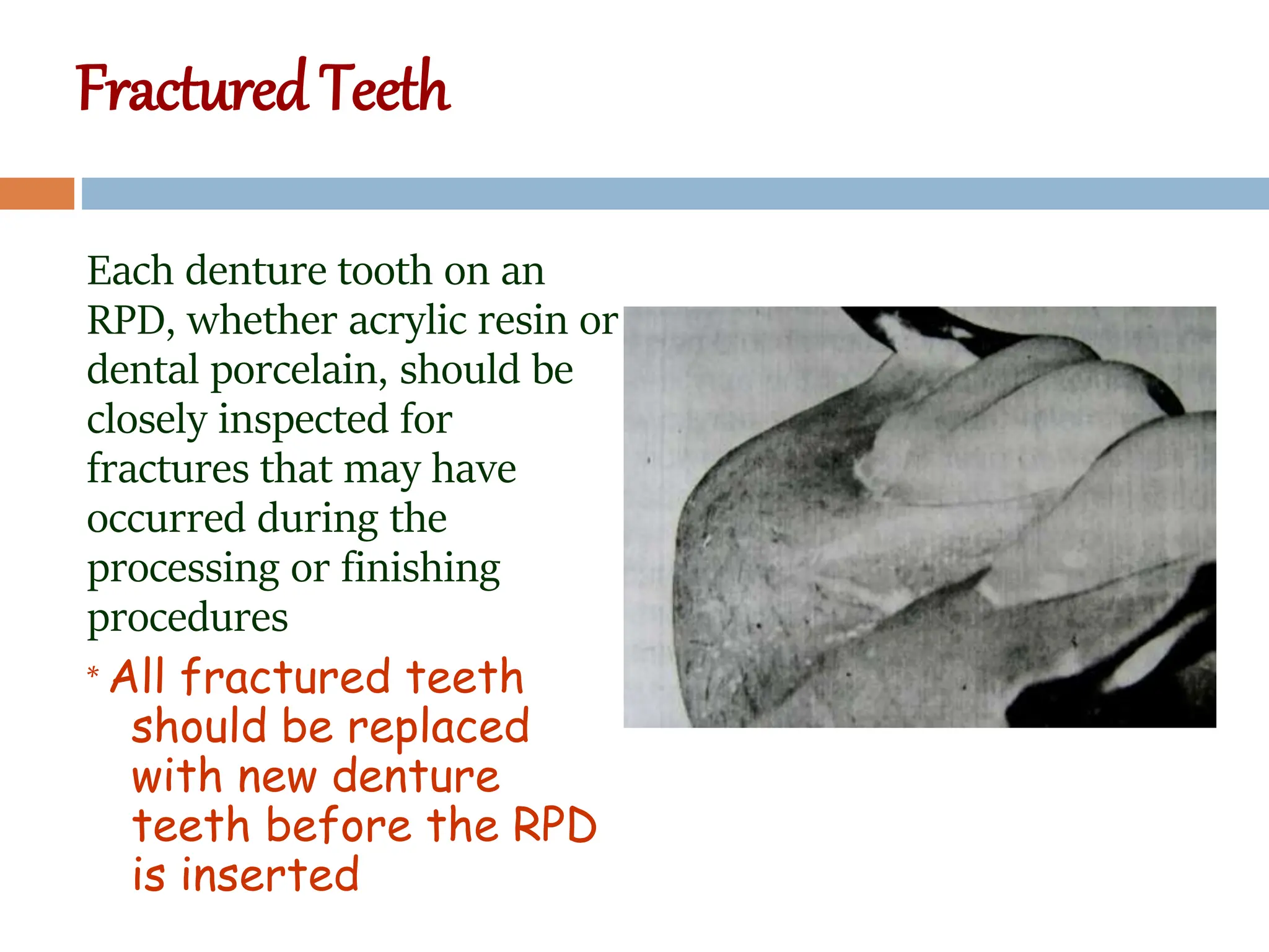 insertion-and-postinsertion-of-Removable partial denture | PPT