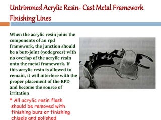 insertion-and-postinsertion-of-Removable partial denture | PPT