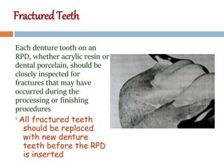 insertion-and-postinsertion-of-Removable partial denture | PPT