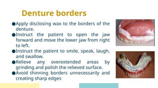 insertion of complete denture by marwa amer.pptx
