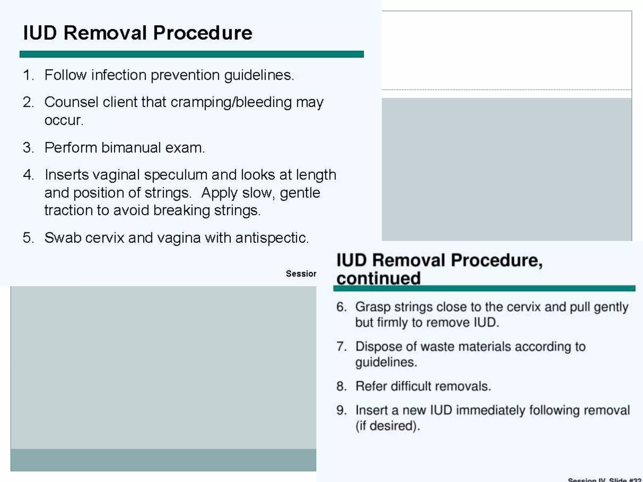 insertion of IUD devices.pptx