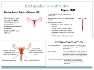 insertion of IUD devices.pptx