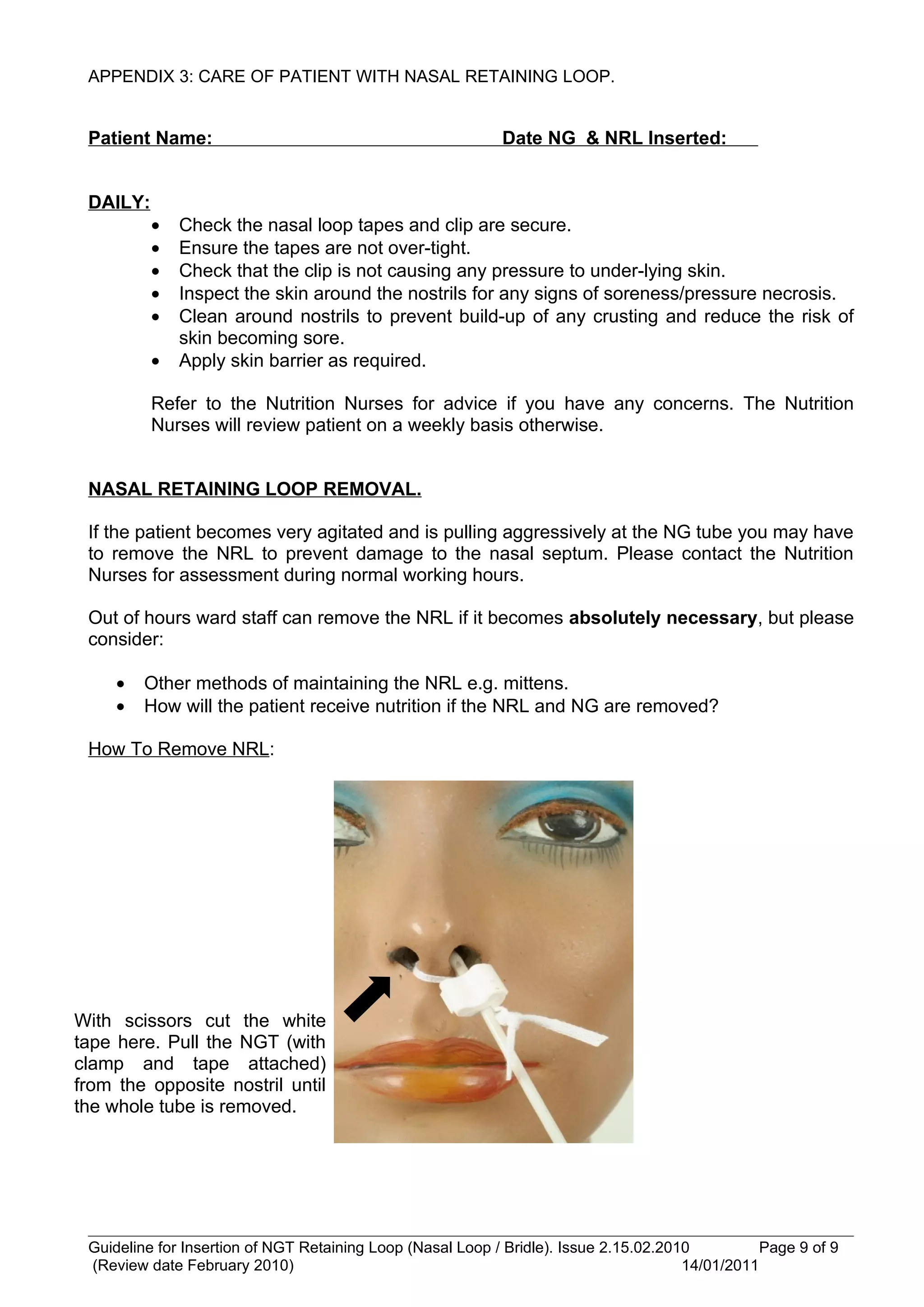 Insertion of ngt retaining device nasal loop bridle | PDF