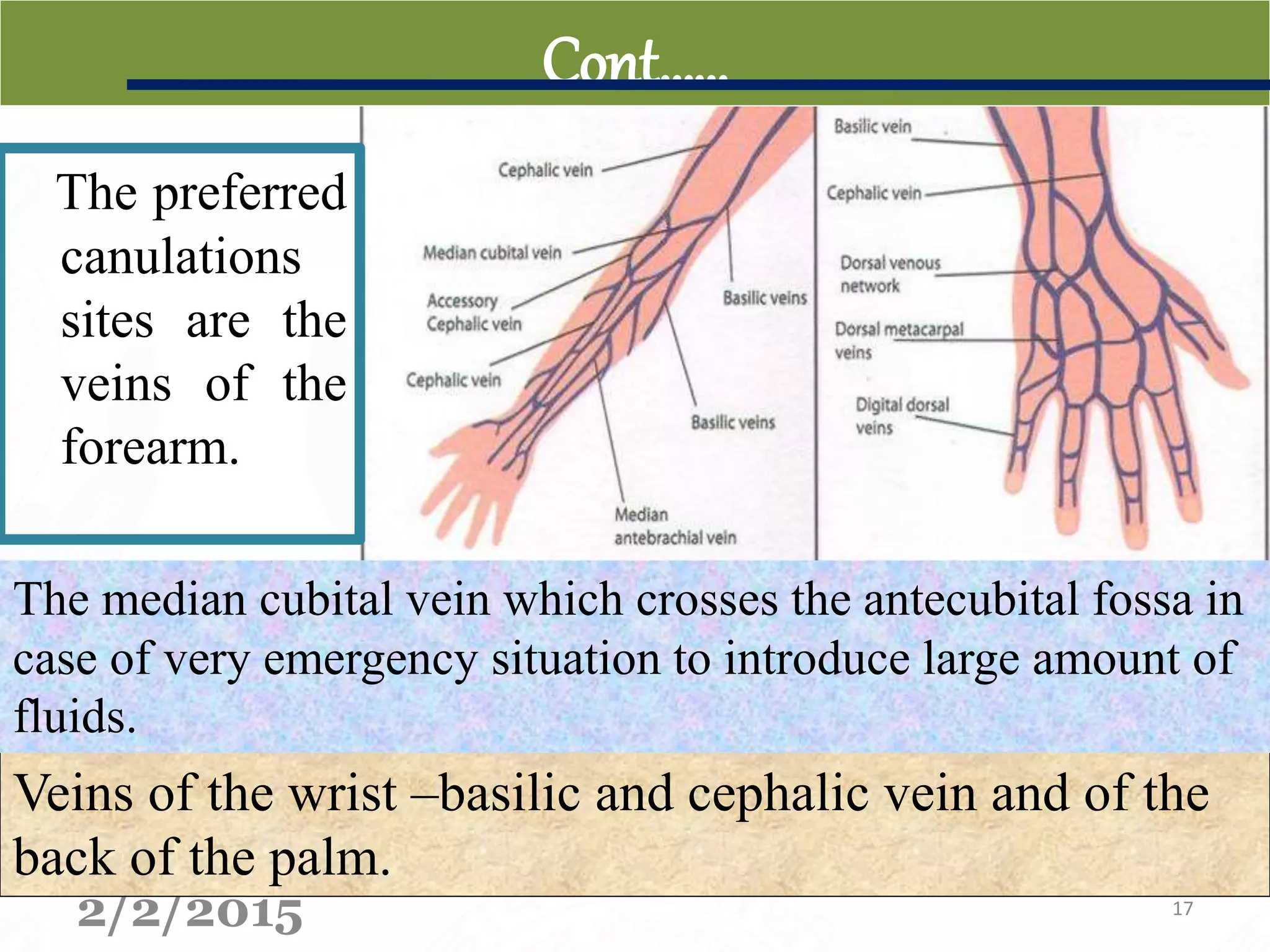 Intravenous canulation, its complication and nursing management | PPSX