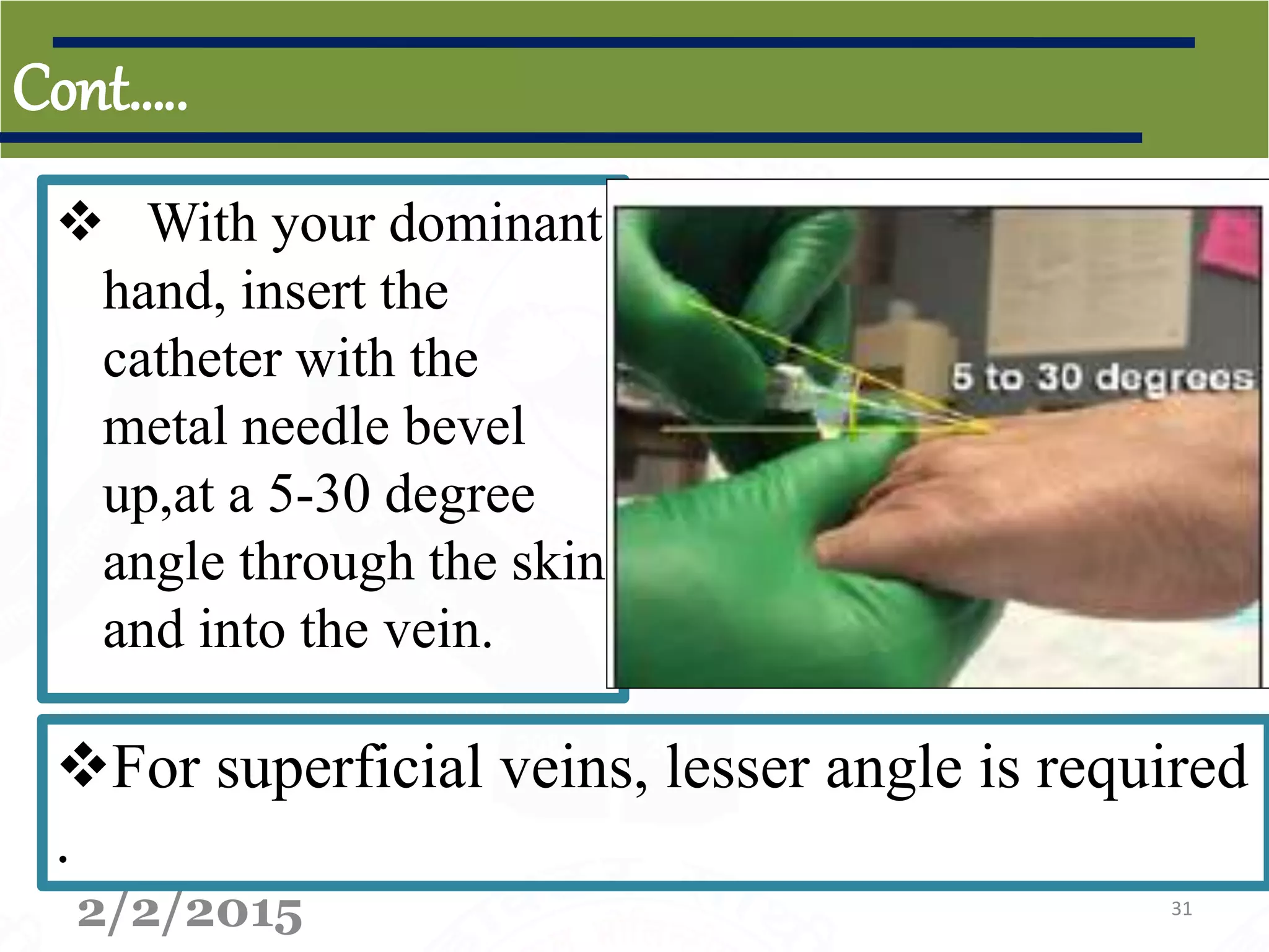 Intravenous canulation, its complication and nursing management | PPSX