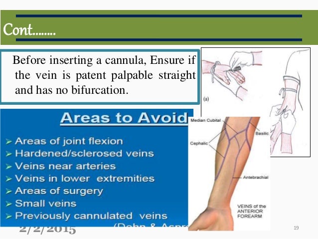 Intravenous canulation, its complication and nursing management