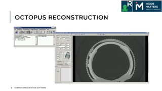 Inside Matters - 3D X-Ray Microscopy - Software - Octopus Imaging | PPT