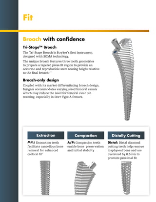 Insignia Design Rationale TKA hip Insignia Design Rationale | PDF
