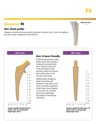 Insignia Design Rationale TKA hip Insignia Design Rationale | PDF