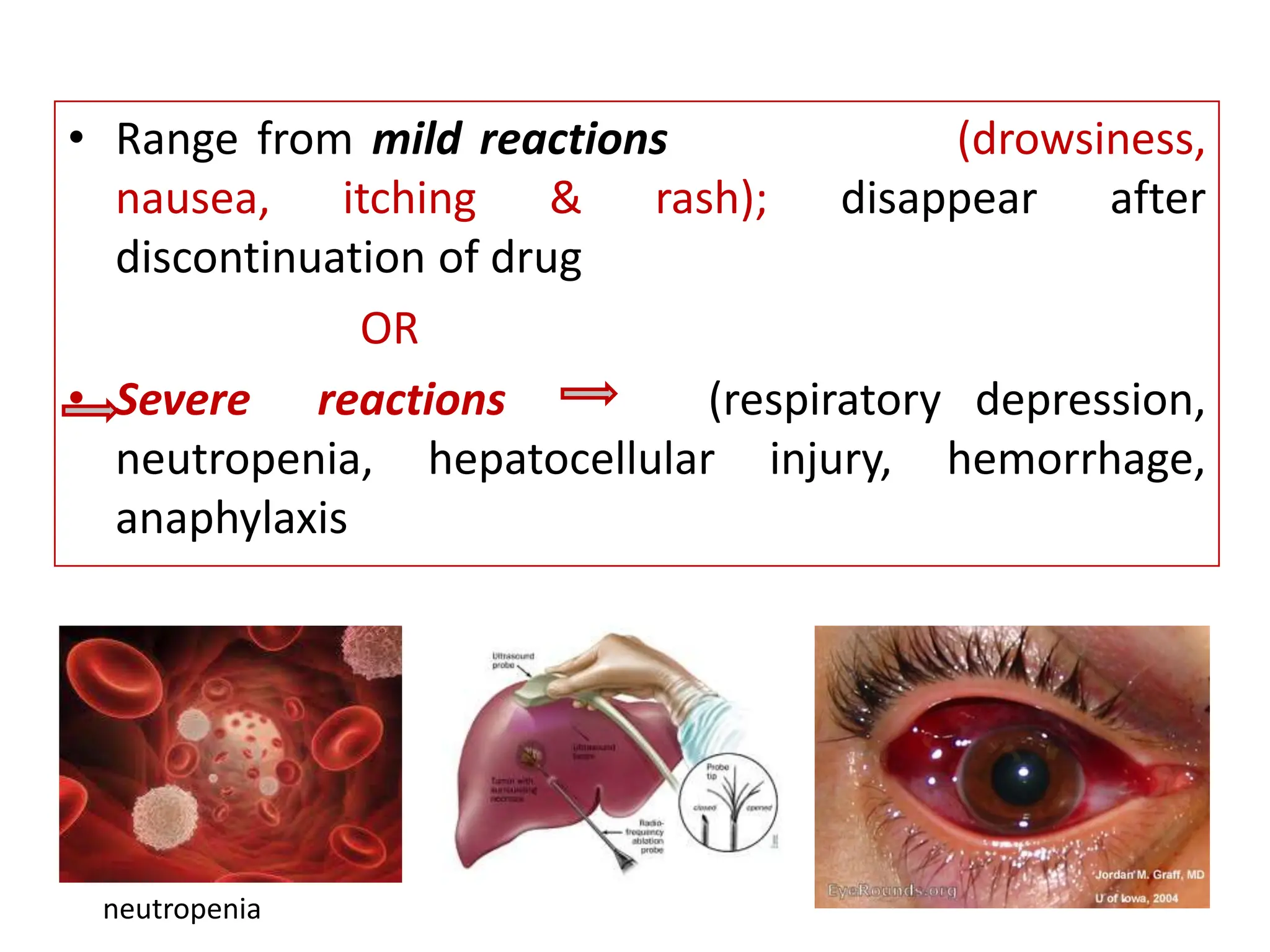Adverse drug reactions & PK and PD - PPT | PPT