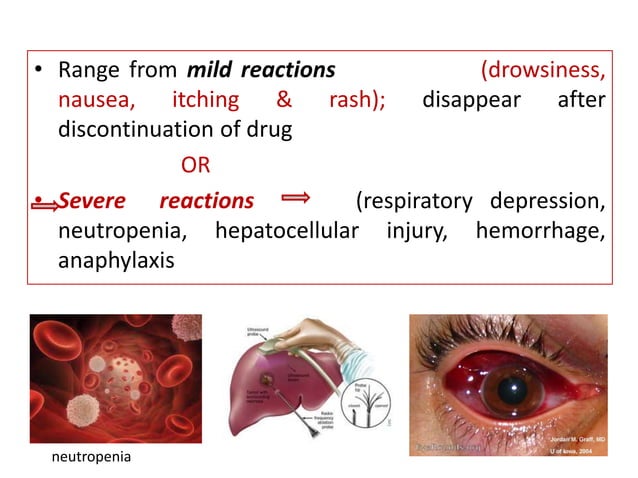 Adverse drug reactions & PK and PD - PPT | PPT
