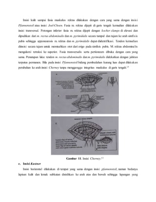Insisi | DOCX