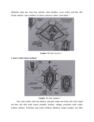 Insisi | DOCX