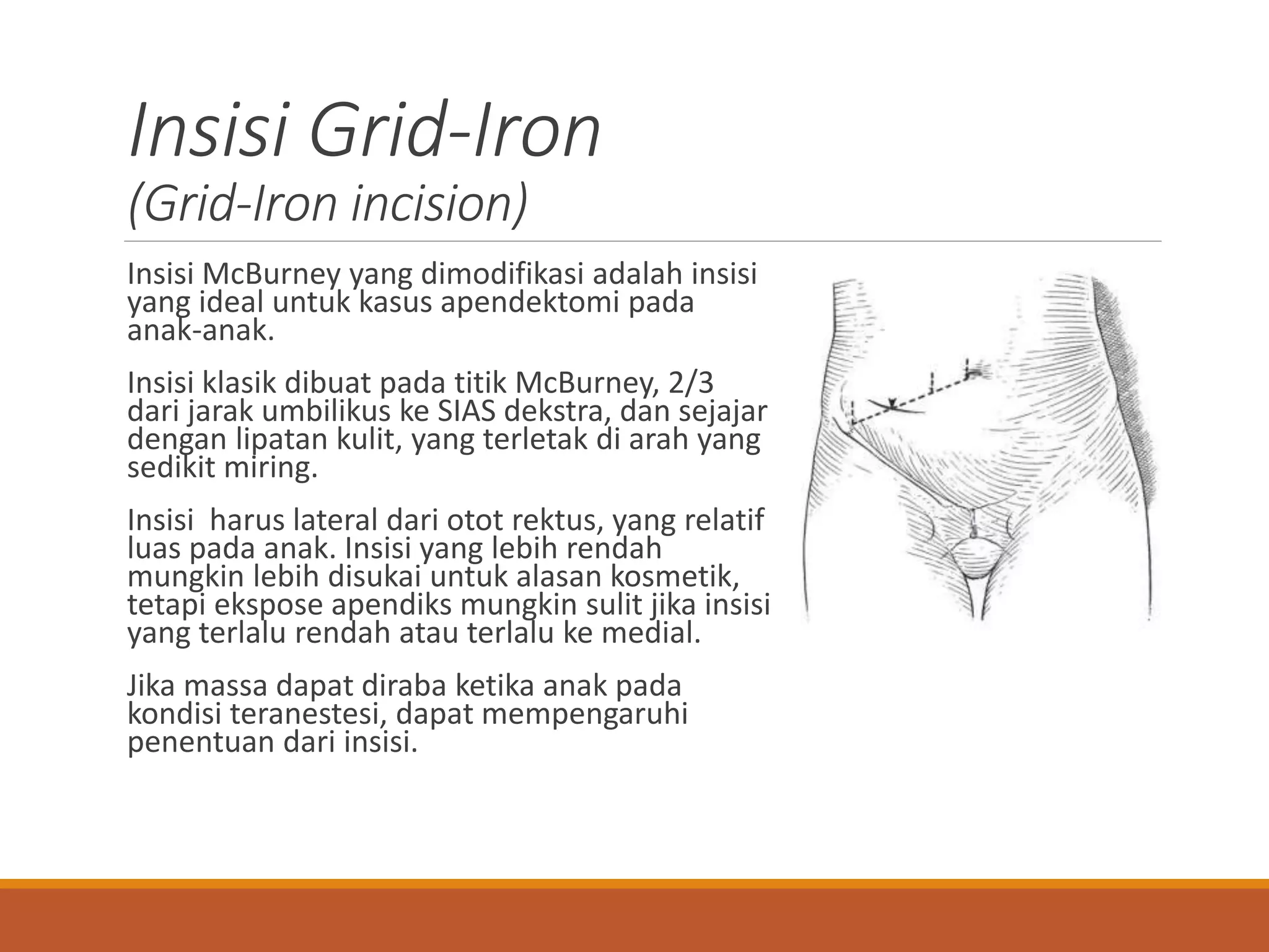 Insisi abdomen pada anak | PPTX